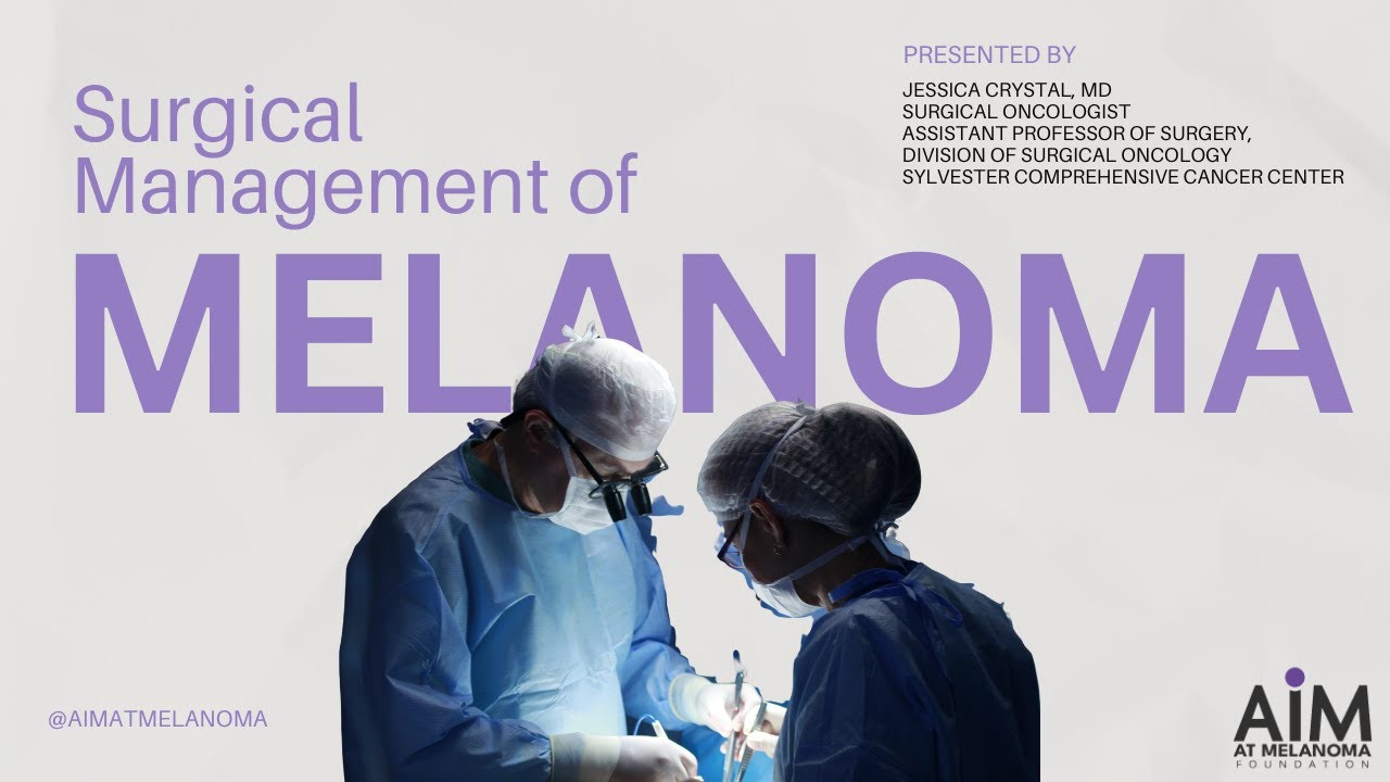 Surgical Management in Melanoma: When Is Systemic Treatment Before Surgery Indicated?