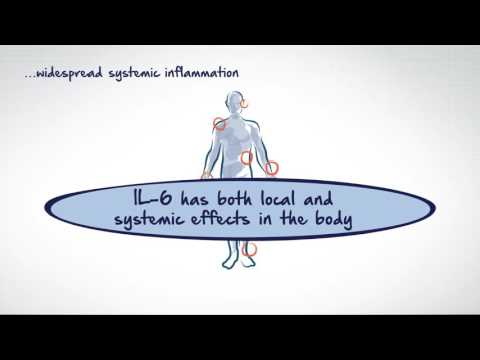 The role of interleukin-6 in autoimmune diseases