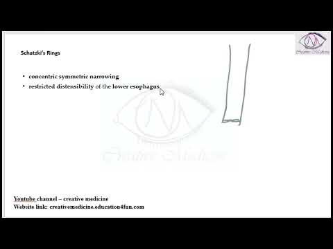 Lec 1 Schatzki’s Rings mp4
