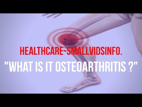 "What is Osteoarthritis? Discover the Basics!"