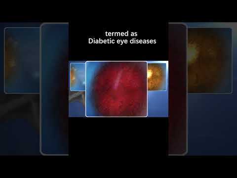 Can I have Glaucoma from diabetes?