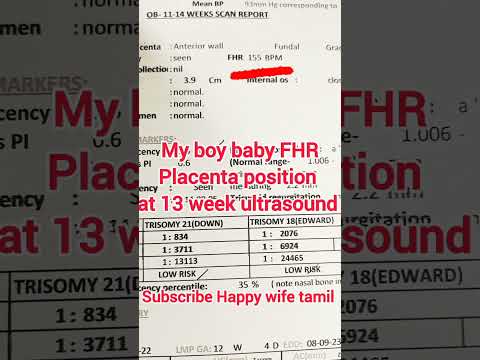 Boy Baby 👦 NT scan Full Report|Importance of NT scan report and explanation of complete Scan report