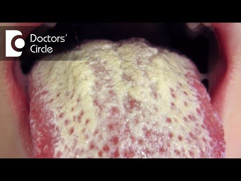 How to manage yellow coating on tongue with red spots on palate? - Dr. Kiran Kumar