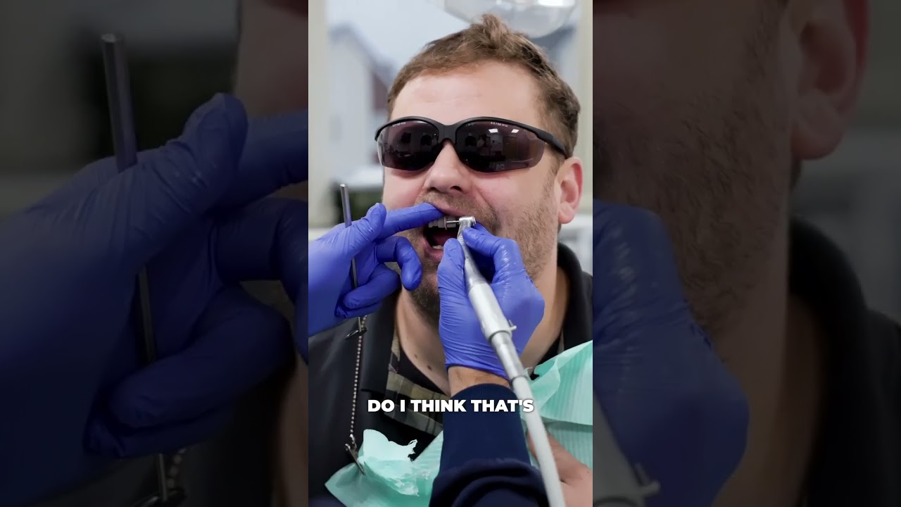 ark dentistry composite bonding case study1