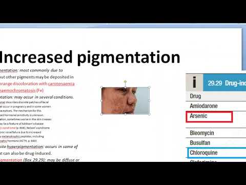 Medicine 1280 Skin Pigmentation Medical Cause Dermatology Skin Hypo Hyper