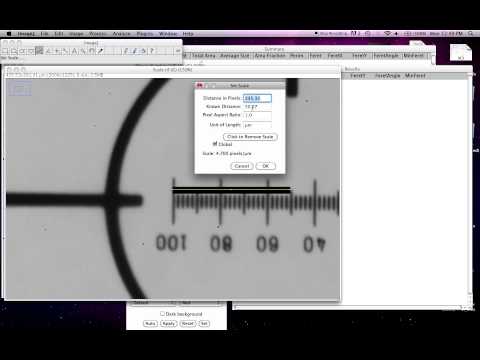 Image J Set Scale Tutorial.