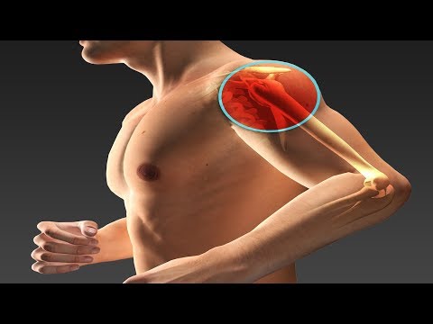 What are Shoulder Labrum Tears and How Are They Treated? | Dr. Walter Stanwood