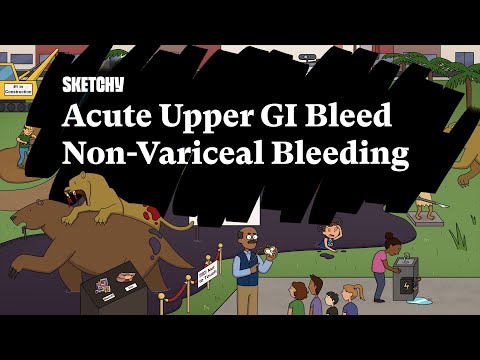 Acute Upper GI Bleed Lesson (Non-Variceal Bleeding)(Full Lesson) | Sketchy Medical | USMLE Step 2 CK