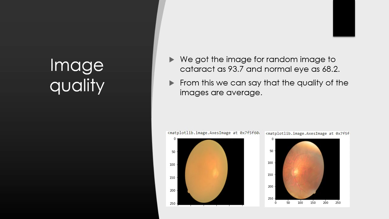 Cataract detection using machine learning