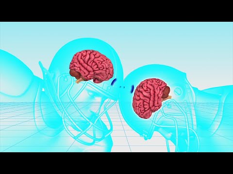 99% of NFL players in brain study suffered from chronic traumatic encephalopathy
