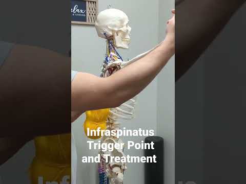 Infraspinatus Treatment #triggerpointtherapy #rotatorcuffexercise #massagetraining #rotatorcuffrehab