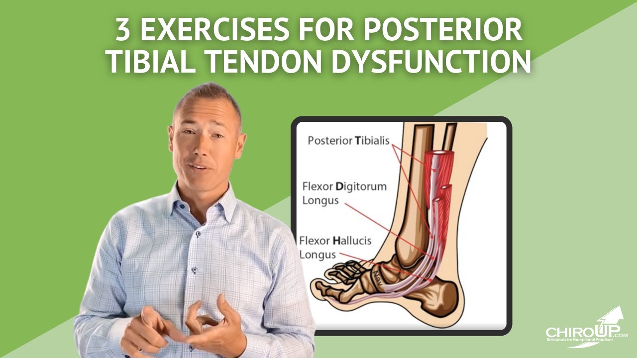 3 Exercises for Posterior Tibial Tendon Dysfunction