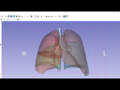 Lung CT Segmenter now supports 'lungmask' AI for lung and lobe ...