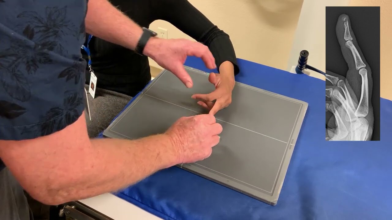 Fingers and Thumb - X Ray Position