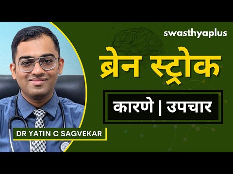 ब्रेन स्ट्रोकची कारणे कोणती? | Brain Stroke: Know the Symptoms, in Marathi | Dr Yatin C Sagvekar