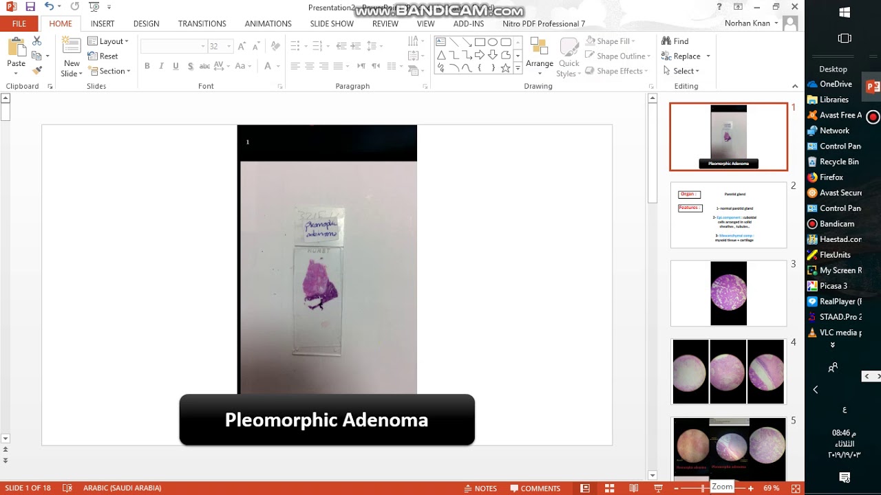 Practical Pathology ( slides ) Part 1 - GIT