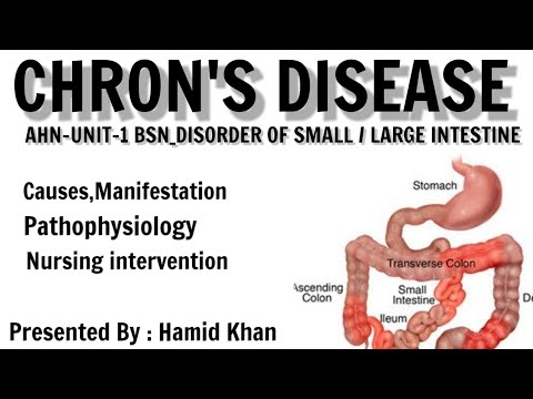 Chron's disease in Urdu||causes manifestation nursing intervention|| Ahn Unit 1 GI disorder