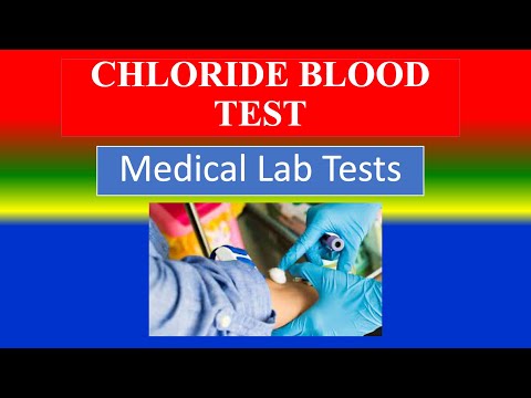 CHLORIDE BLOOD TEST - Medical Lab Tests - What is ? , Uses , Need , Preparation , Results