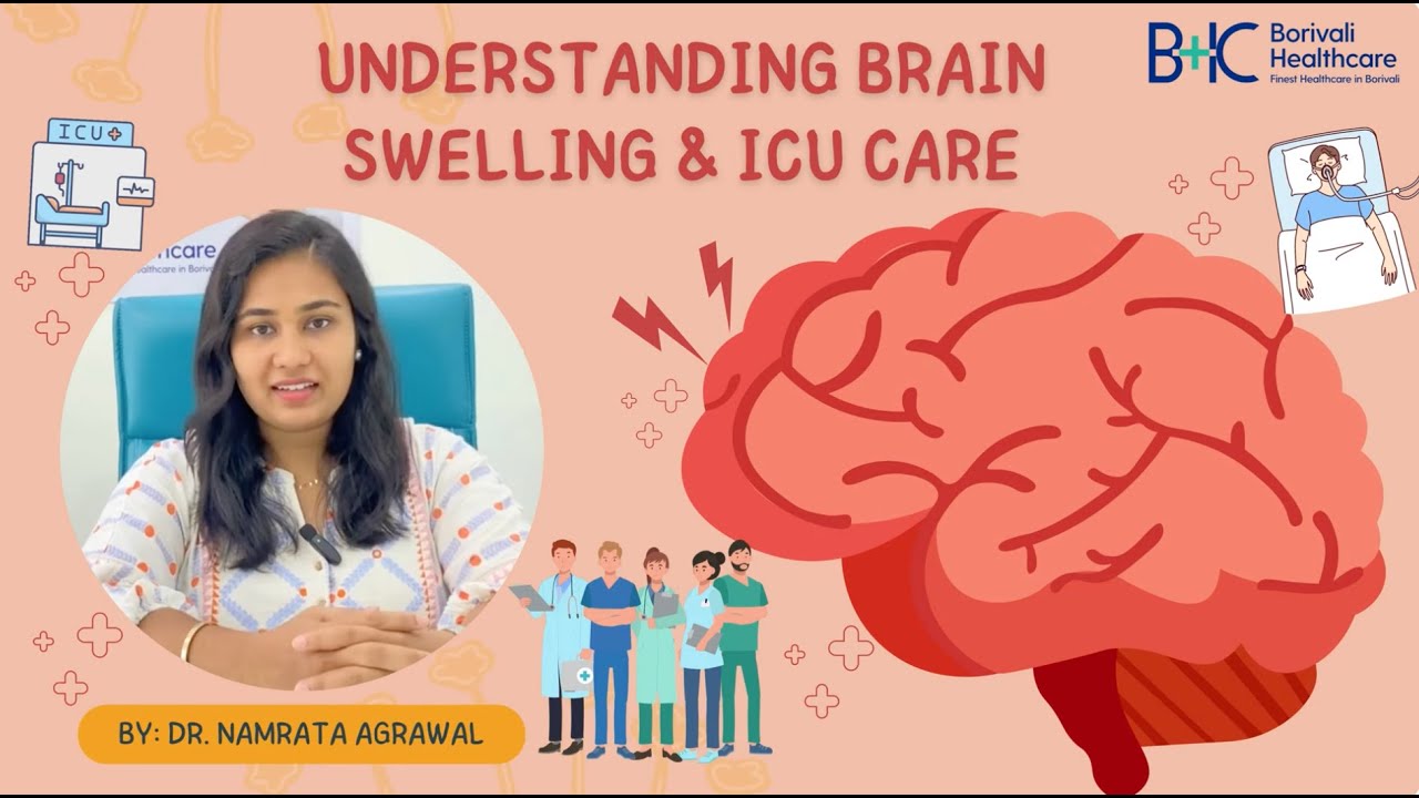 Understanding Brain Swelling (Cerebral Edema) | ICU Insights with Dr. Namrata Agrawal | #BrainSwell