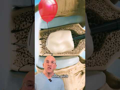 Innovative Spine Fracture Treatment: Balloon + Cement 🎈#shorts