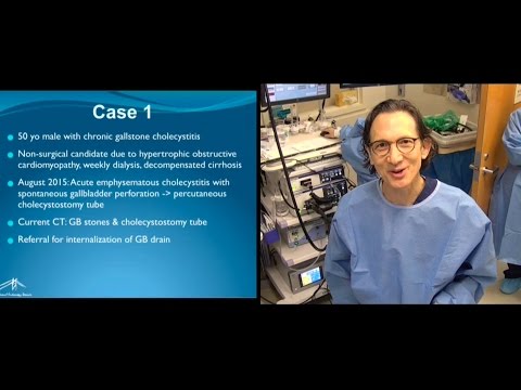 HARBOR UCLA 2016 CASE 1 GB drainage HD