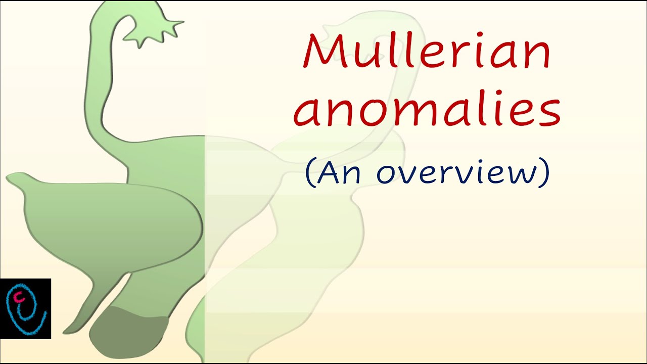 Mullerian anomalies - an overview