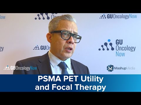 PSMA PET Utility for Determining Optimal Candidates for Focal Therapy