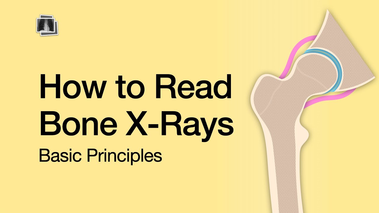 How to Read Bone X-Rays