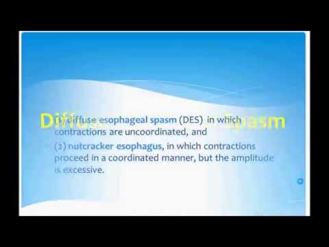 USMLE: What you need to know about diffuse esophageal spasm,(e)