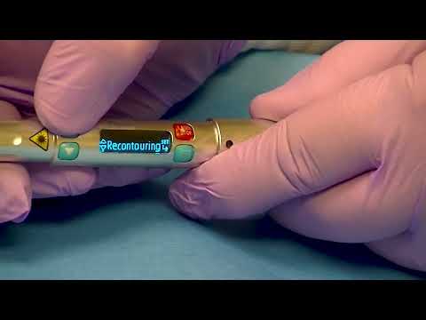 NV® PRO3 Microlaser - Get To Know Your Laser - DenMat Dental Education