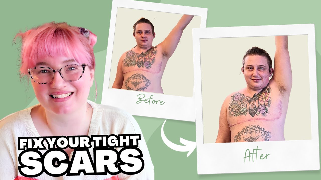 Scar Massage Tutorial: Get Your Mobility Back after Surgery (Lasting Relief!)