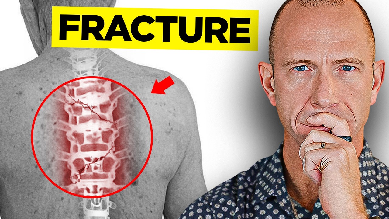 Reversing Osteoporosis Naturally: A Patient's Journey to Better Bone ...