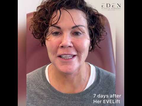 EVELift Facelift Patient Testimonial | Dr. Ali Charafeddine Eden Plastic Surgery Miami FL