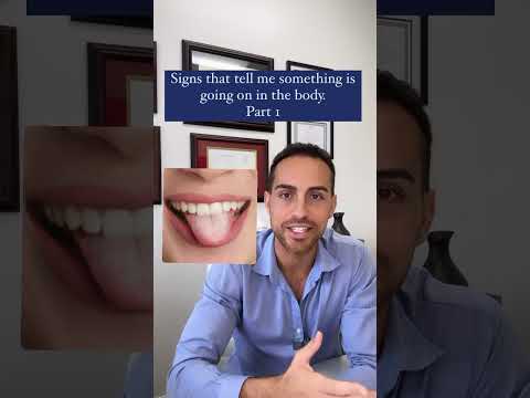 Do You Have A White Coat On Your Tongue? #candida #tongue #guthealth