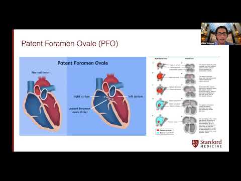 Structural Interventions in Cardiology | Stanford Department of Medicine Grand Rounds | 23 June 2021