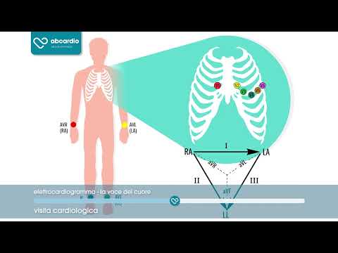La Visita Cardiologica in Abcardio Bologna