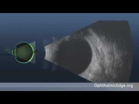 Lecture 4 How Does an A Scan Become a B Scan