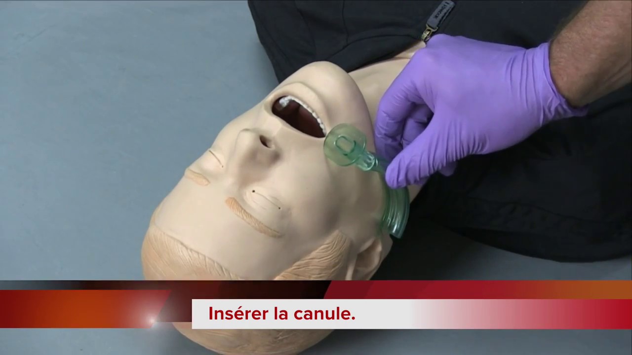 2  Insertion de la canule oropharyngée