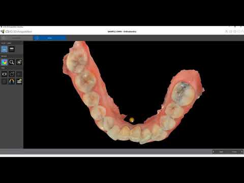 CS 3600 - Intraoral Camera Function Video