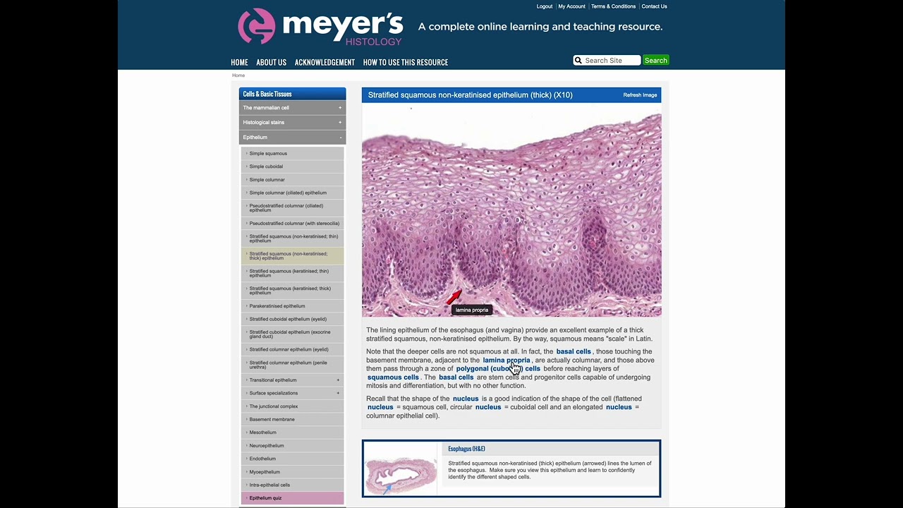 View a demonstration of the Award-Winning Meyer's Histology Online Interactive Atlas and Quizzes.