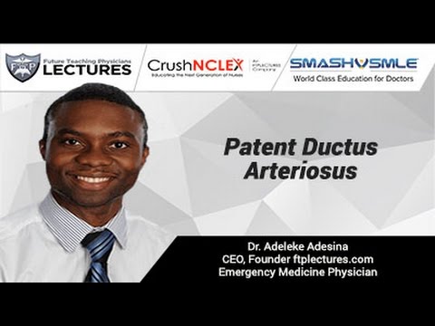 Patent Ductus Arteriosus