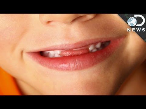 Why Do Some People Have Lisps?