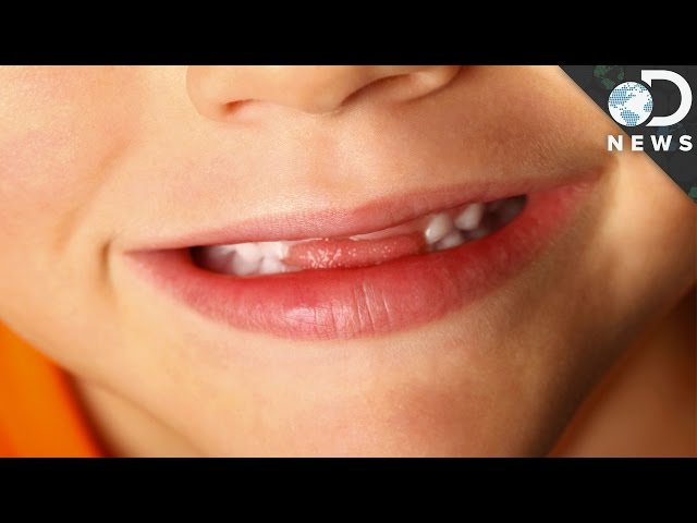 Does Mike Tyson suffer from lisp?