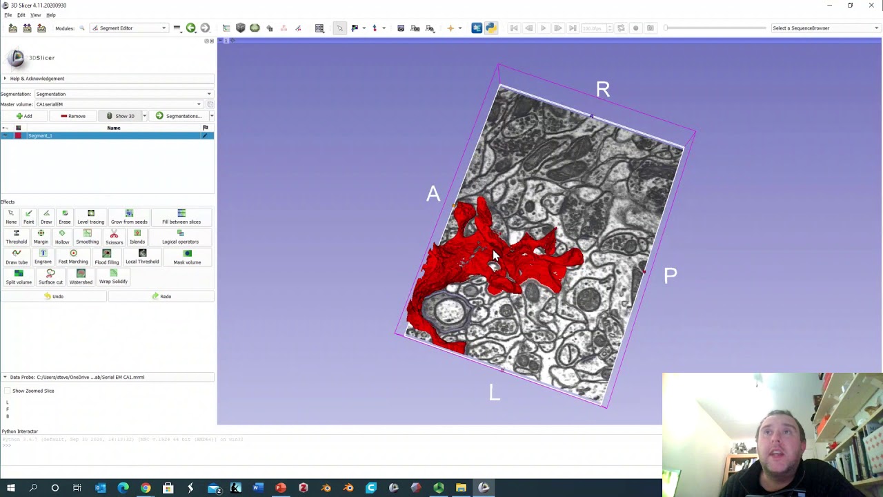 Serial block face scanning electron microscopy   the ultimate connectomics tool