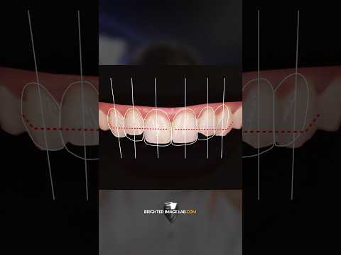 Designing Your Perfect Smile: Before & After Results