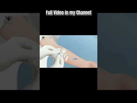 Peripheral Parenteral Nutrition with Lipid (Fat) Emulsion #shorts #tpn