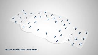 Inserting and Starting Guardian™ Sensor - MiniMed™ 780G System Support ...