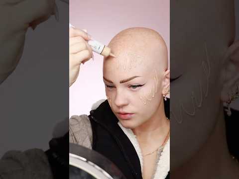 Things you DIDN’T KNOW about Alopecia