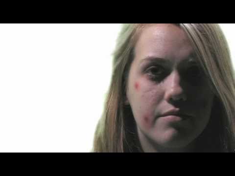 “Meth Scars” PSA | Davalosfilm LIVE