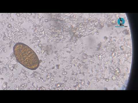 Identify the Ova of Parasite? #parasite #stool #microscope #laboratory #diagnosis #parasitology